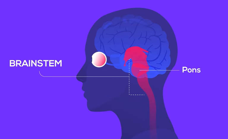 Locked in Syndrome: Actual Case, Symptoms, Causes & Diagnosis Locked in Syndrome: Actual Case, Symptoms, Causes & Diagnosis